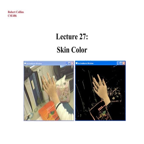 Lecture27 | PDF | Skin and Dermatology | Diseases and Conditions
