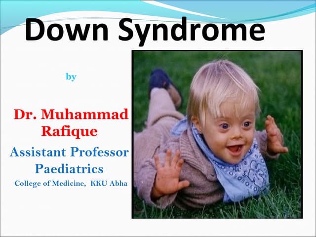 Lecture Down Syndrome Ppt