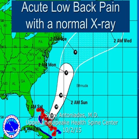 Low Back Pain with a normal xray | PPTX