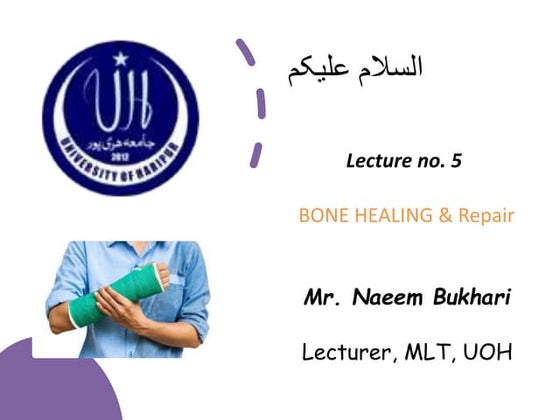 Stages of bone healing and various factors | PPTX