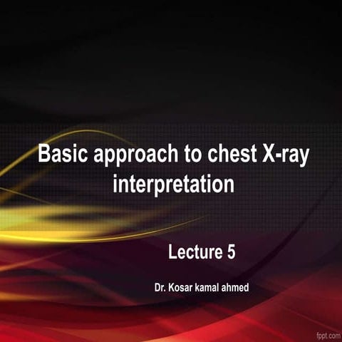 The radiology assistant chest x ray - basic interpretation | PDF