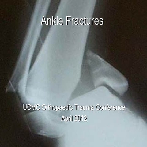Lecture trauma ankle_fracture | PPT