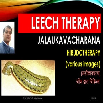 Leech therapy, Hirudotherapy, Jalaukavacharana, लीच थेरेपी | PPT