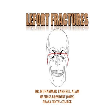 LEFORT FRACTURES.pptx