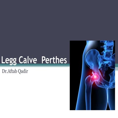Legg calve perthes | PPT