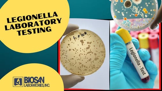 Rapid Legionella PCR test | PDF | Infectious Diseases | Diseases and ...