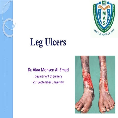 Leg Ulcer.pptx