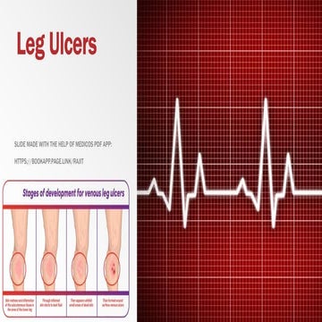 Leg ulcers | PPT
