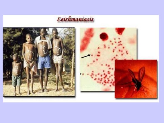 Leishmania | PPTX | Skin and Dermatology | Diseases and Conditions