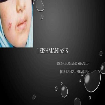 Leishmaniasis | PPTX