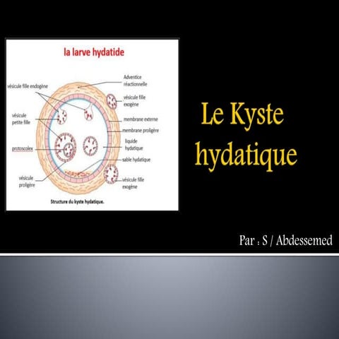 Formes Rares et Particulières du Kyste hydatique | PPTX