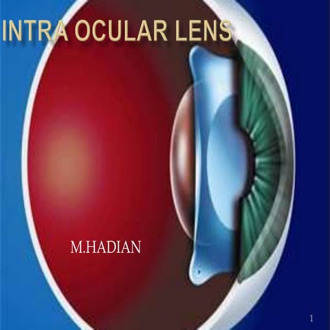 Intraocular lens | PPT