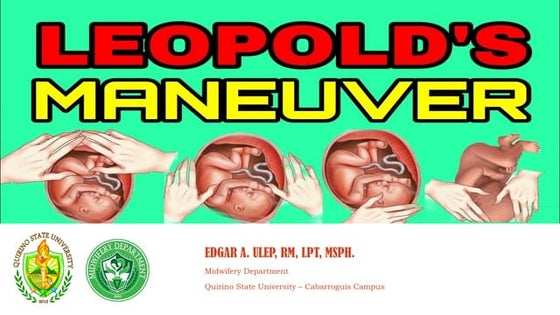 Leopold’s Maneuver | PPTX | Pregnancy | Reproductive Health