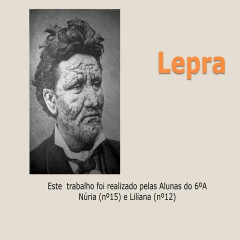 Lepra | PPT