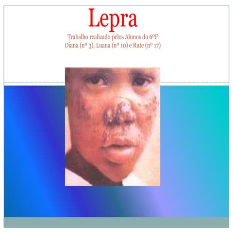 Lepra | PPTX