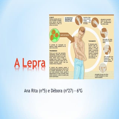 Lepra | PPTX