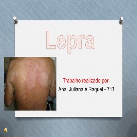 Lepra | PPTX