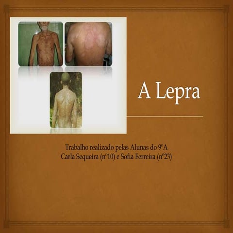 Lepra | PPT