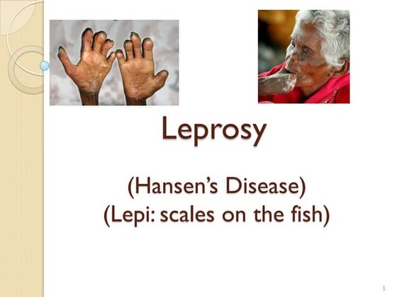 Leprosy | PPT