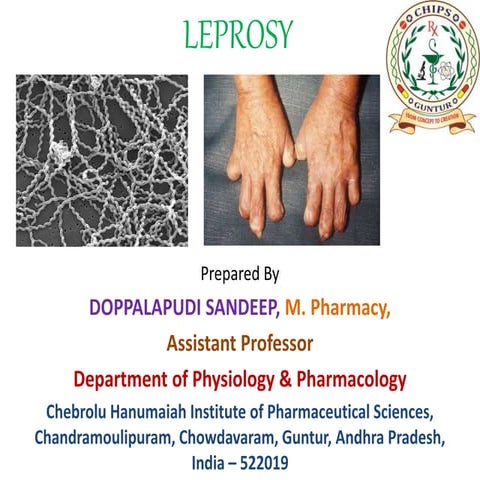 Leprosy | PPT