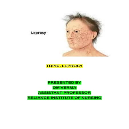 Leprosy | PPT