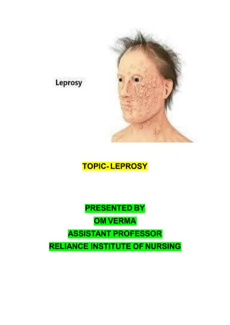 Directly observed treatment short course | PPT