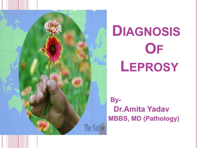 Pathophysiology of Leprosy | PDF