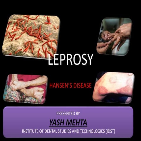 Leprosy, its pathogenesis and microbiology | PPTX