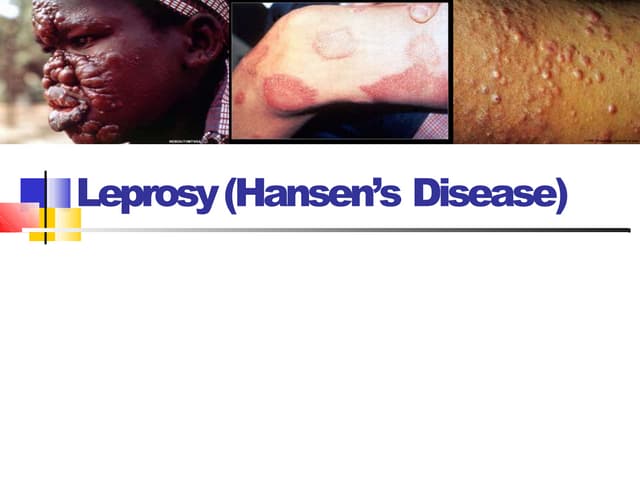 Pathophysiology of Leprosy | PDF