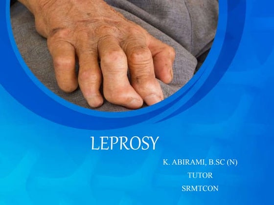 Leprosy | PPT | Infectious Diseases | Diseases and Conditions