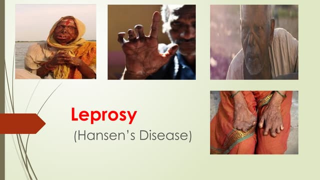 Leprosy | PPTX