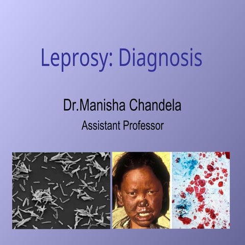 Leprosy - diagnosis and management - Copy.ppt