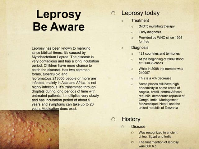 Leprosy | PPT