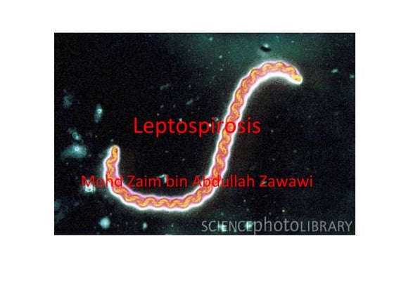 Leptospirosis | PPTX