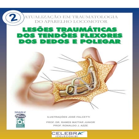 Tendão Flexor Longo Dos Dedos