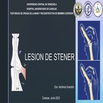 LESION DE STENER lesion de stener le.pptx
