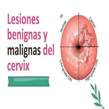lesiones-benignas-y-malignas-del-cervix-240212124622-6b9758a1.pdf