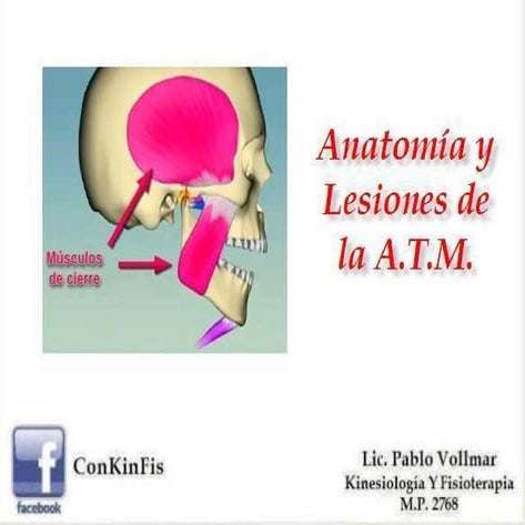 lesiones articulacion temporo maxilar atm.PDF