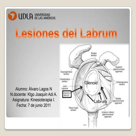Lesiones del labrum y disyuncion 2011 Alvaro Lagos | PPTX