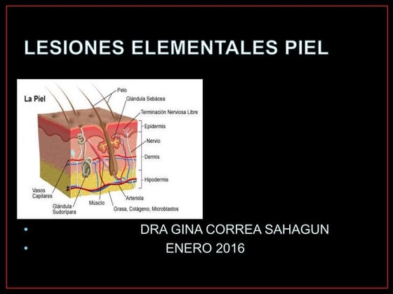 Escala edema | PDF