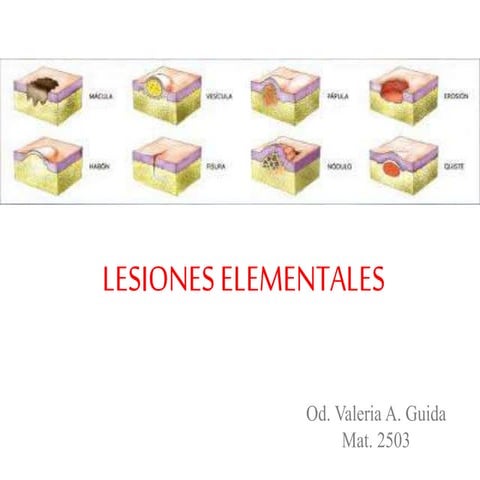Lesiones Elementales Pptx