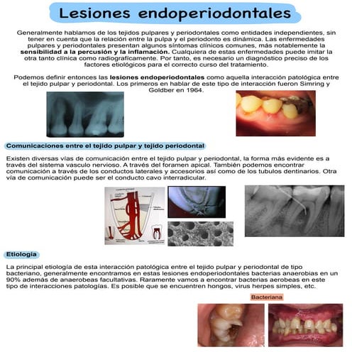 Clasificación de la patología pulpar y periapical según la AAE (1).pdf