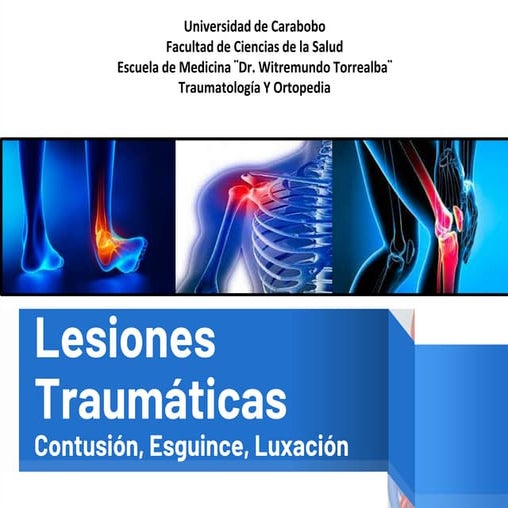 Lesiones traumáticas. Contusión, esguince y luxación | PPTX