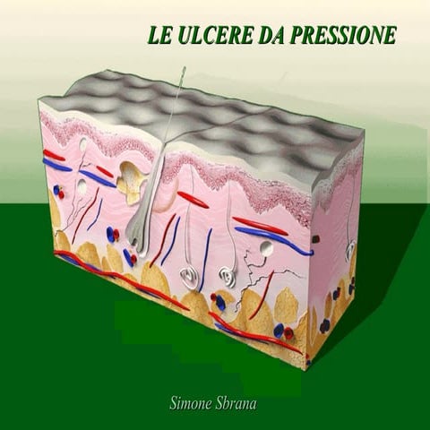 Le scale di valutazione del rischio per lesioni da decubito | PDF
