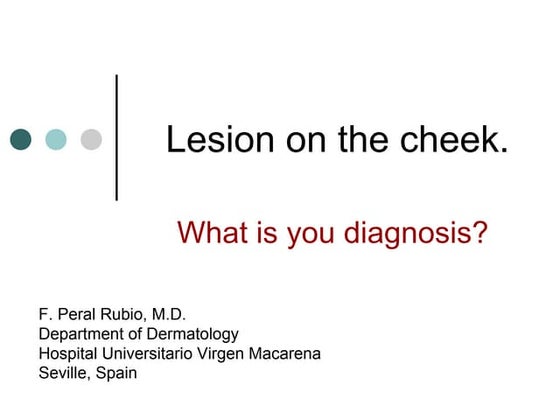 Lesion on the back 2013 | PPT | Skin and Dermatology | Diseases and ...