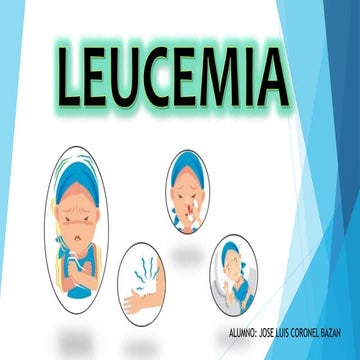 LEUCEMIA.pptx