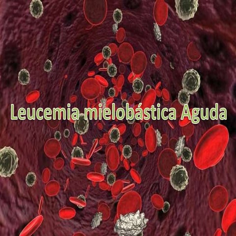 Leucemia | PPTX