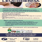 Leucoderma - Causes, Symptoms and Herbal Treatment