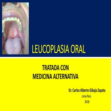 LEUCOPLASIA TRATADA CON MEDICINA ALTERNATIVA | PPTX