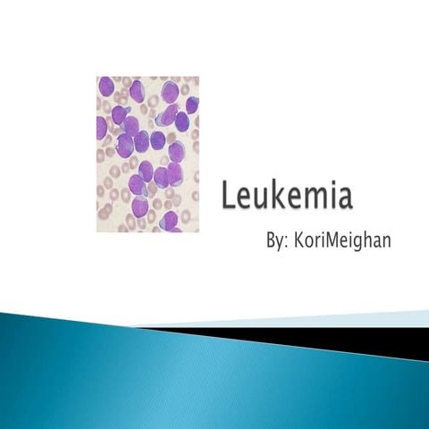 Leukemia | PPTX